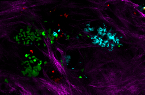 Illuminating Cancer Mechanisms Through Confocal Microscopy - Wiley ...