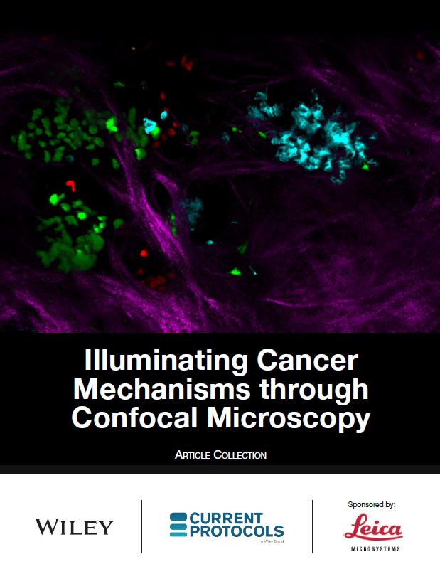 Illuminating Cancer Mechanisms Through Confocal Microscopy - Wiley ...